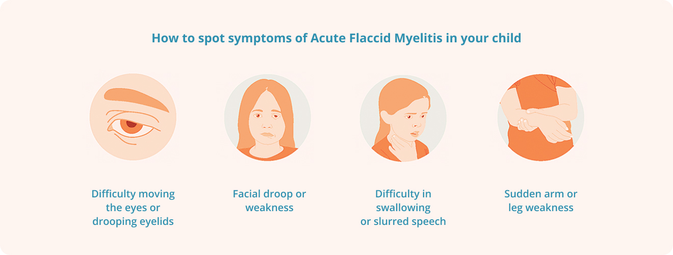 A Complete Guide to Acute Flaccid Myelitis in Children - Avisena ...